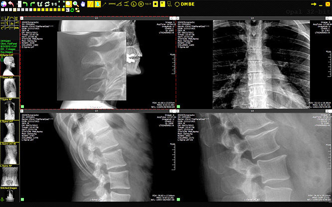 Sistema de transmissão para exames de imagem - Opal-Rad - 20/20 Imaging ...