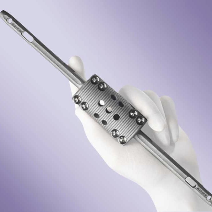 Haste intramedular para fêmur - OsteoBridge™ - Merete - para tíbia ...