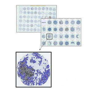 Módulo de software para oncologia - ONCOTOPIX® - Visiopharm - para ...