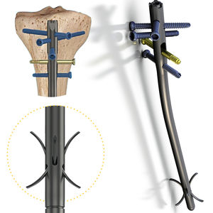 Haste intramedular para tíbia - Todos os fabricantes de equipamentos ...