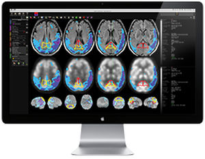 Software SPECT - MIM Encore™ - MIM Software - cardíaco / PET / para ...