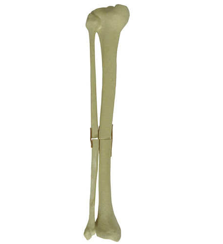 Modelo de osso esponjoso - 9700 - Nacional Ossos - medular / de tíbia ...