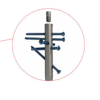 Haste intramedular para úmero - 4T1-4021000 - Ases Orthopedics
