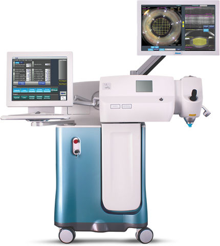 Laser oftalmológico - LENSX® - Alcon - para cirurgia de catarata ...