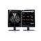 Monitor de diagnóstico - MDNC-6121 - Barco - para mamografia / para ...